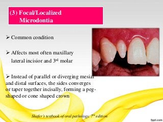 Developmental Anomalies Of Teeth | PPTX