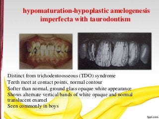 Developmental Anomalies Of Teeth | PPTX