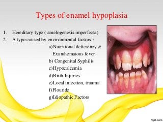 Developmental Anomalies Of Teeth | PPTX