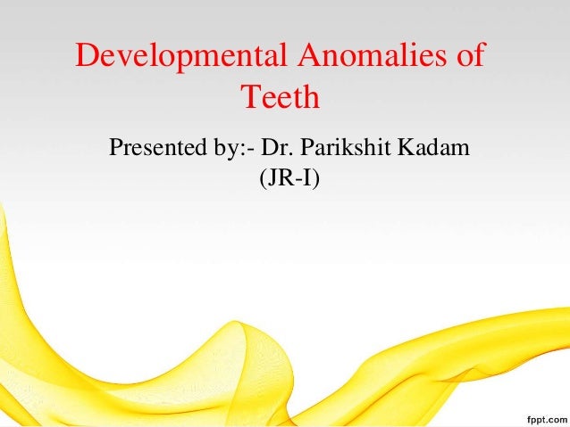 Developmental Anomalies Of Teeth | PPTX