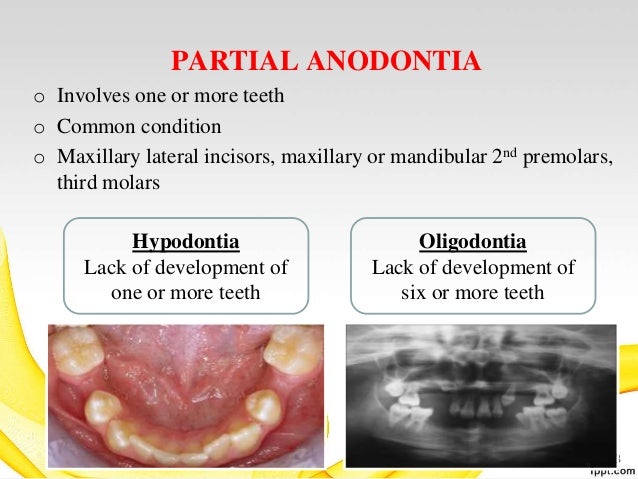 Developmental Anomalies Of Teeth | PPTX