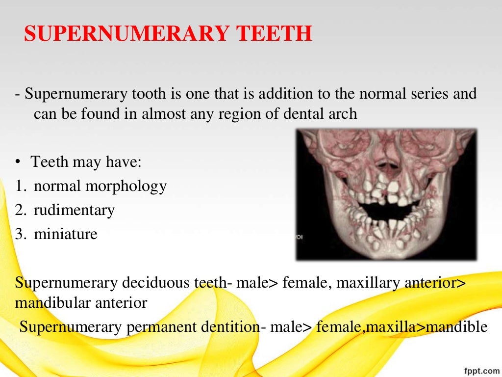 Developmental Anomalies Of Teeth | PPTX