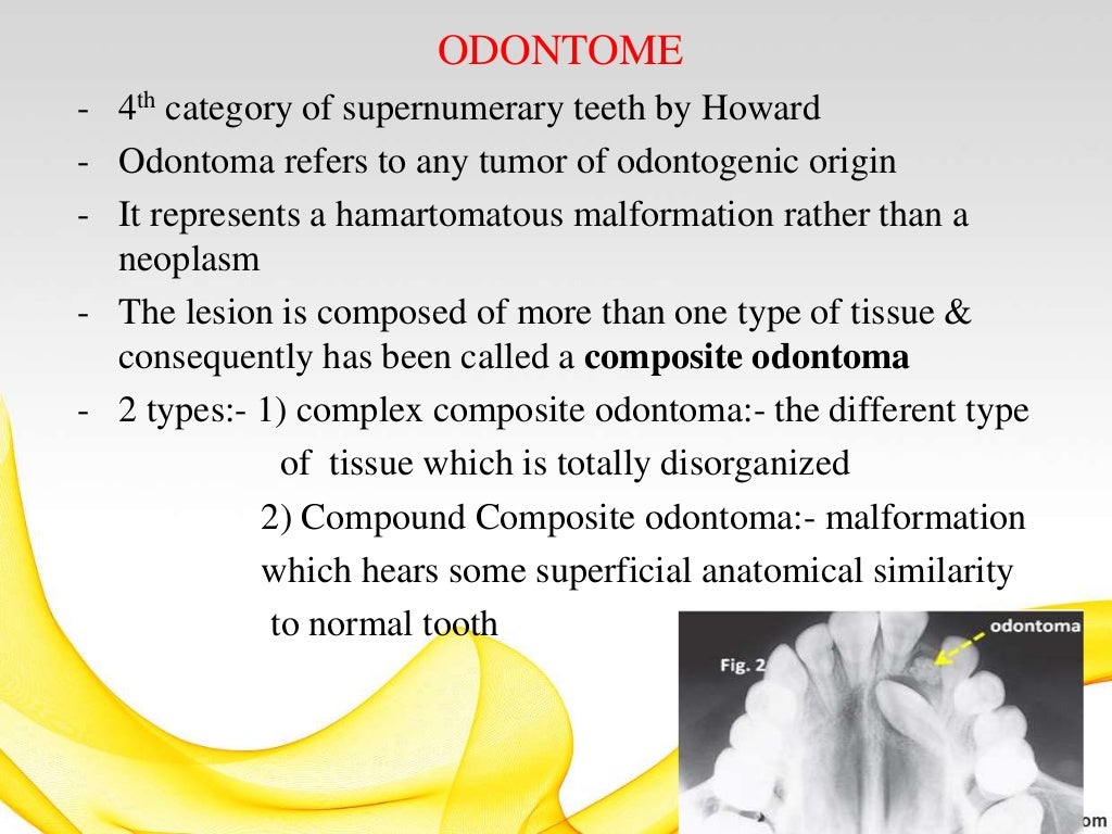 Developmental Anomalies Of Teeth | PPTX