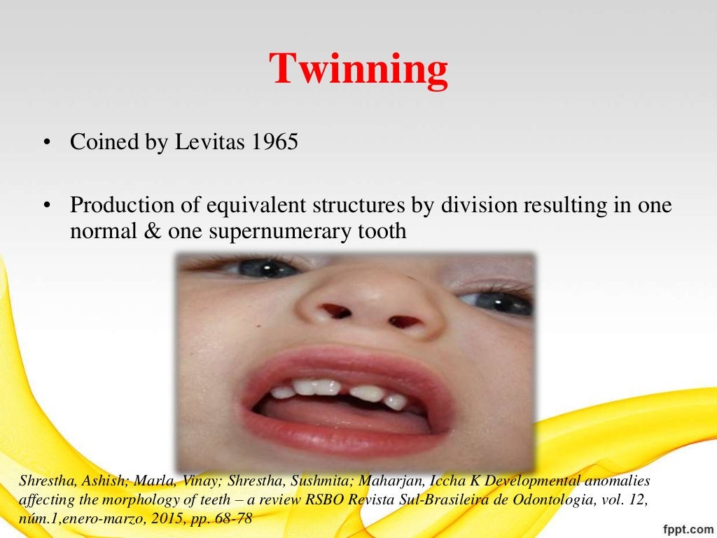 Developmental Anomalies Of Teeth | PPTX