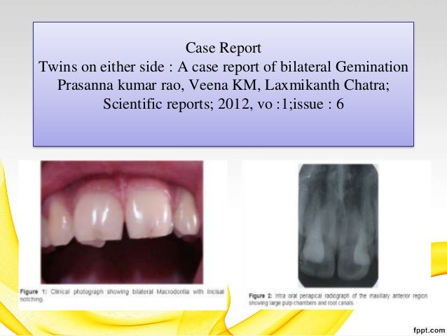 Developmental Anomalies Of Teeth | PPTX