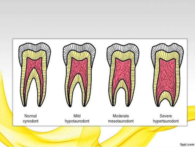 Developmental Anomalies Of Teeth | PPTX