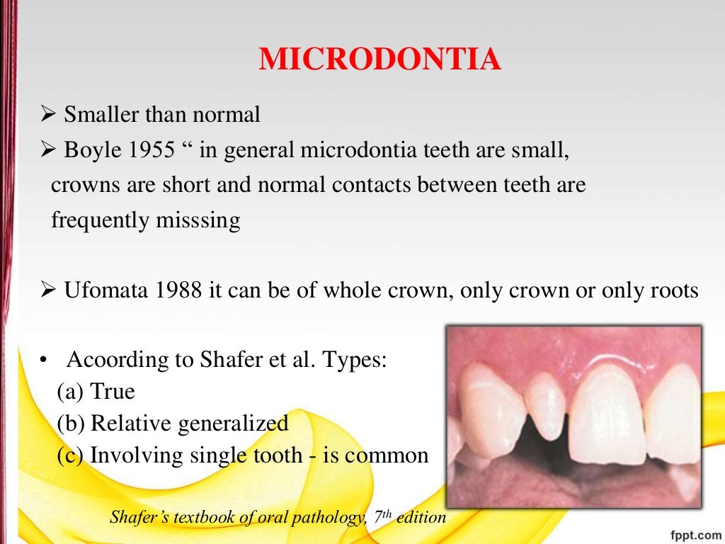 Developmental Anomalies Of Teeth | PPTX