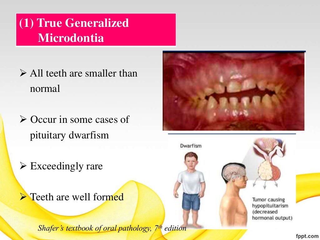 Developmental Anomalies Of Teeth | PPTX
