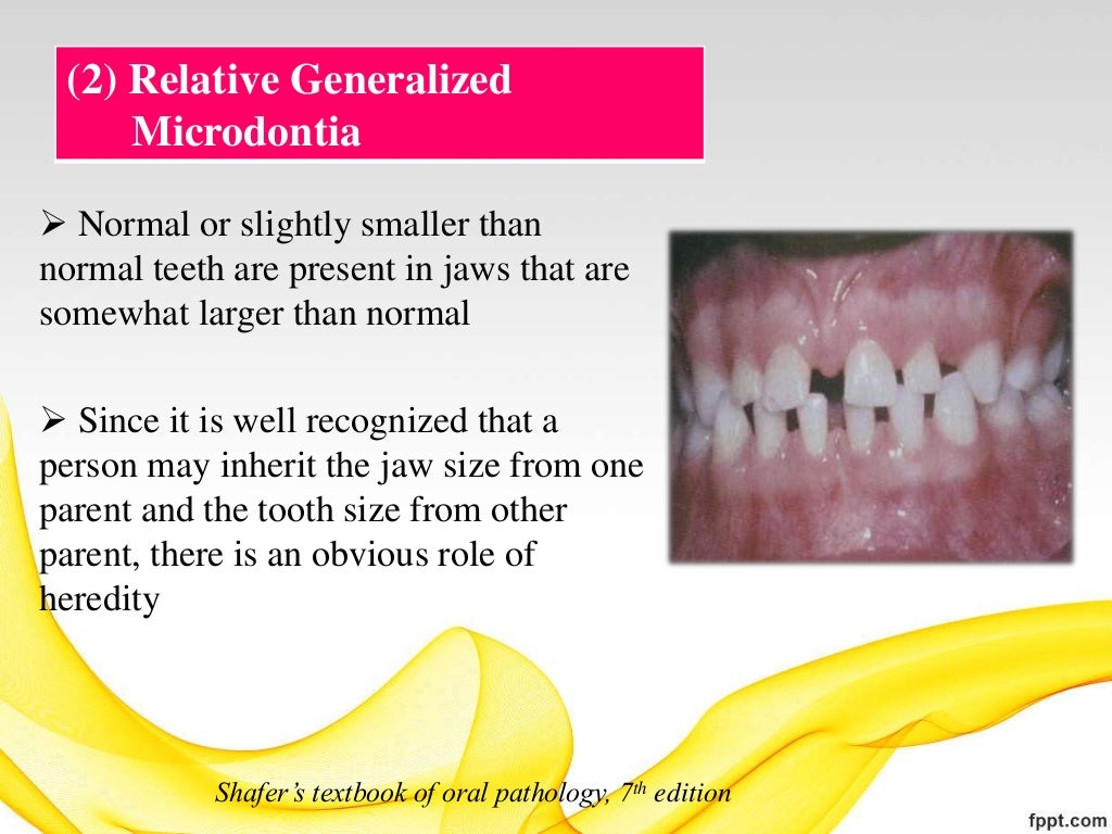 Developmental Anomalies Of Teeth | PPTX