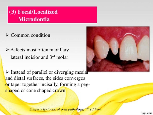 Developmental Anomalies Of Teeth | PPTX