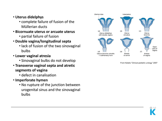 Anomalies of the female interna genitalia GH 23.pdf