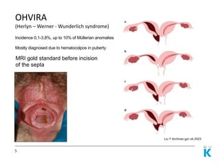 Anomalies of the female interna genitalia GH 23.pdf