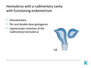 Anomalies of the female interna genitalia GH 23.pdf