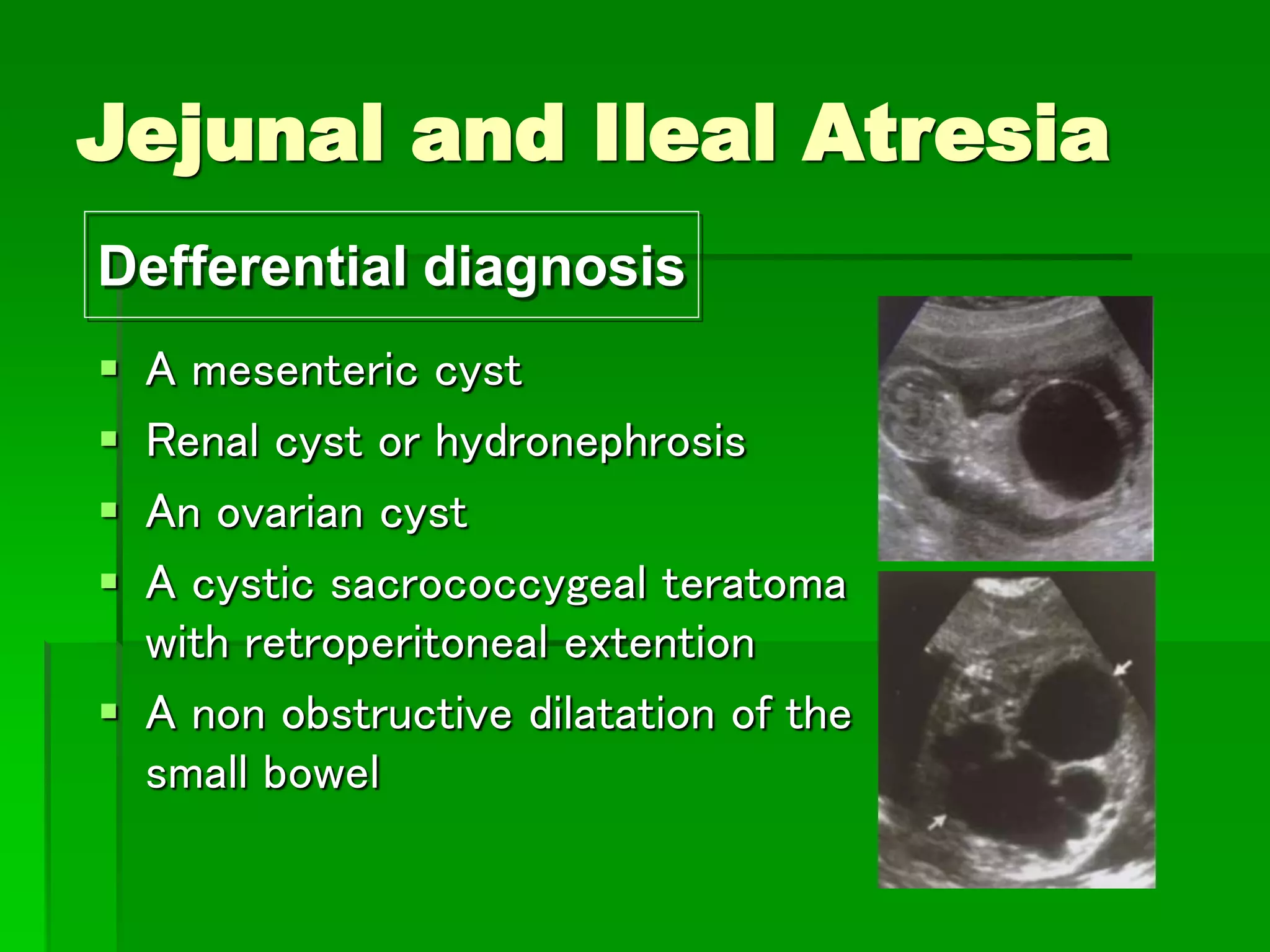 Anomalies of the Gastrointestinal Tract and Anterior Abdominal.ppt