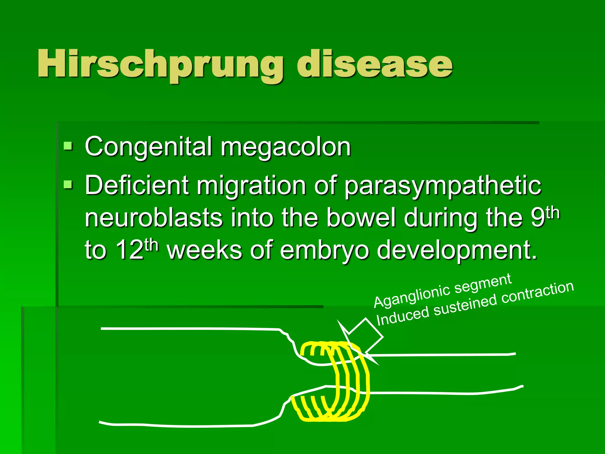 Anomalies of the Gastrointestinal Tract and Anterior Abdominal.ppt