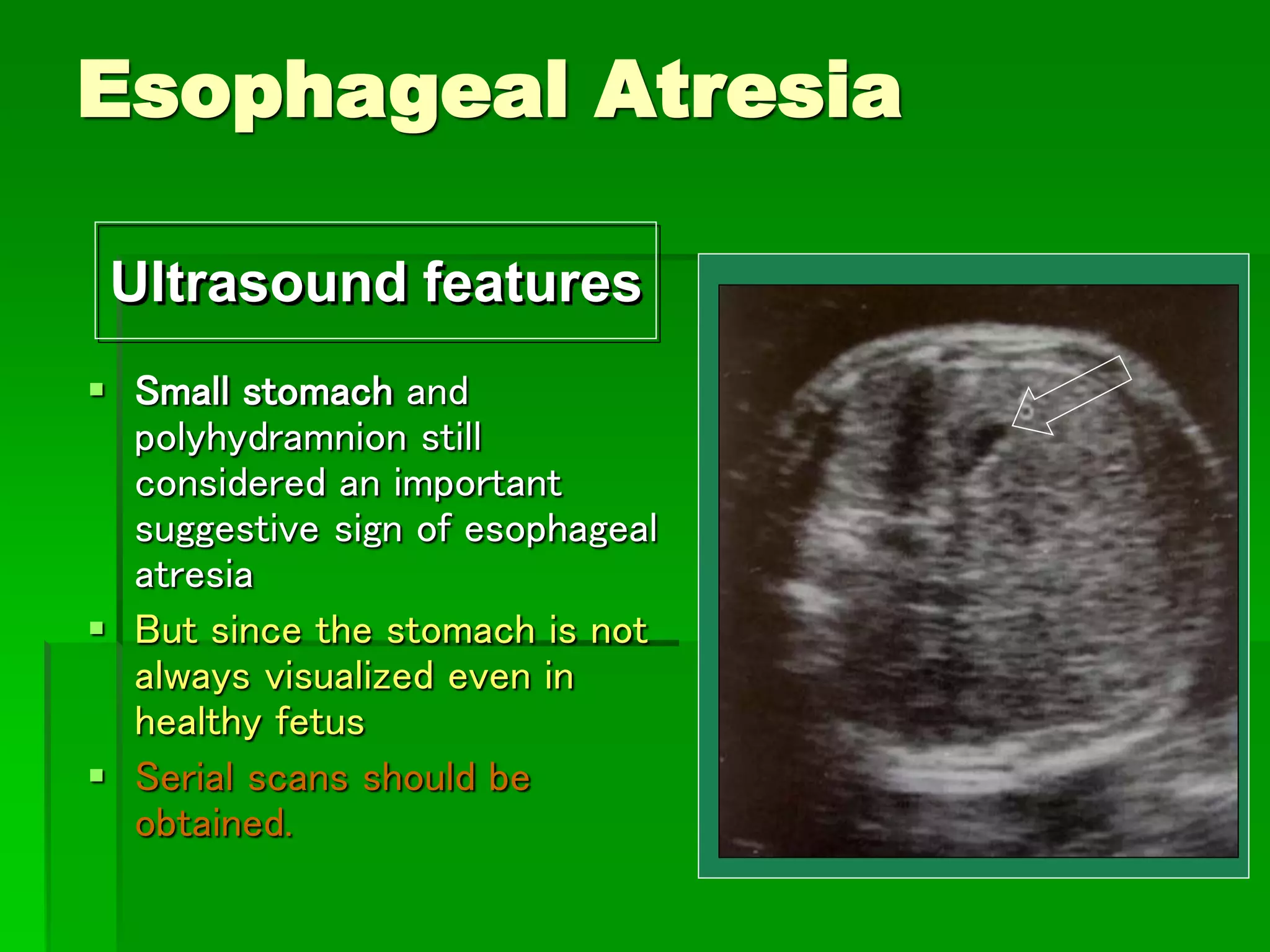Anomalies of the Gastrointestinal Tract and Anterior Abdominal.ppt