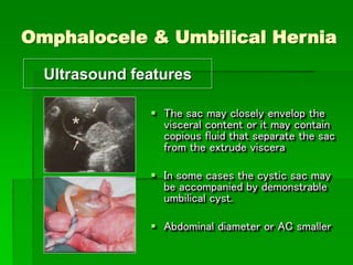 Anomalies of the Gastrointestinal Tract and Anterior Abdominal.ppt