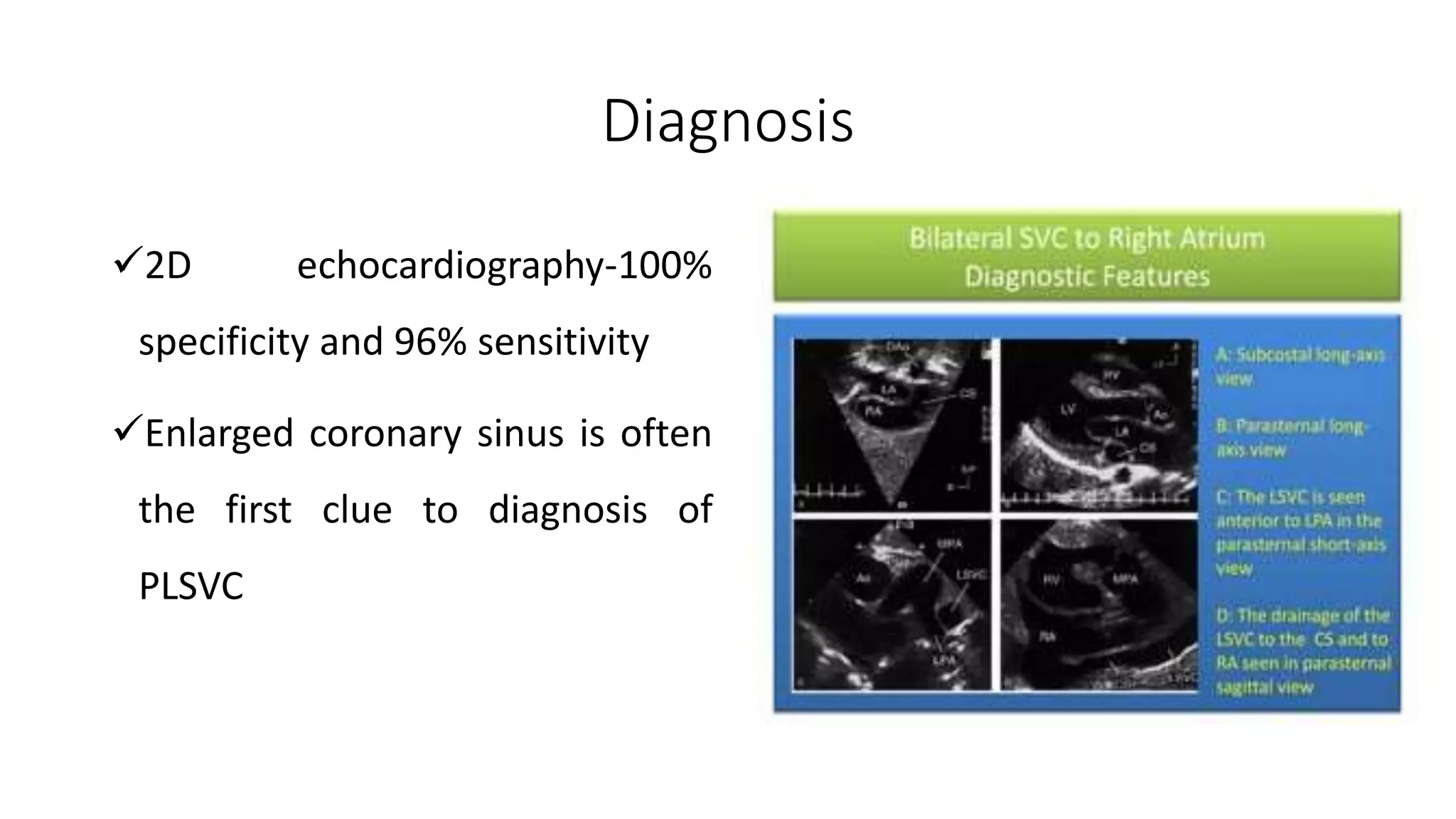 Anomalies of the systemic venous return.pptx