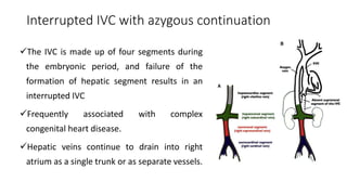Anomalies of the systemic venous return.pptx | Heart and Cardiovascular ...