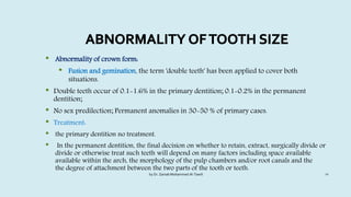 Anomalies of tooth formation and eruption | PPTX