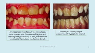 Anomalies of tooth formation and eruption | PPTX