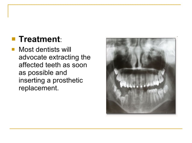 Anomalies of tooth formation & eruption | PPT