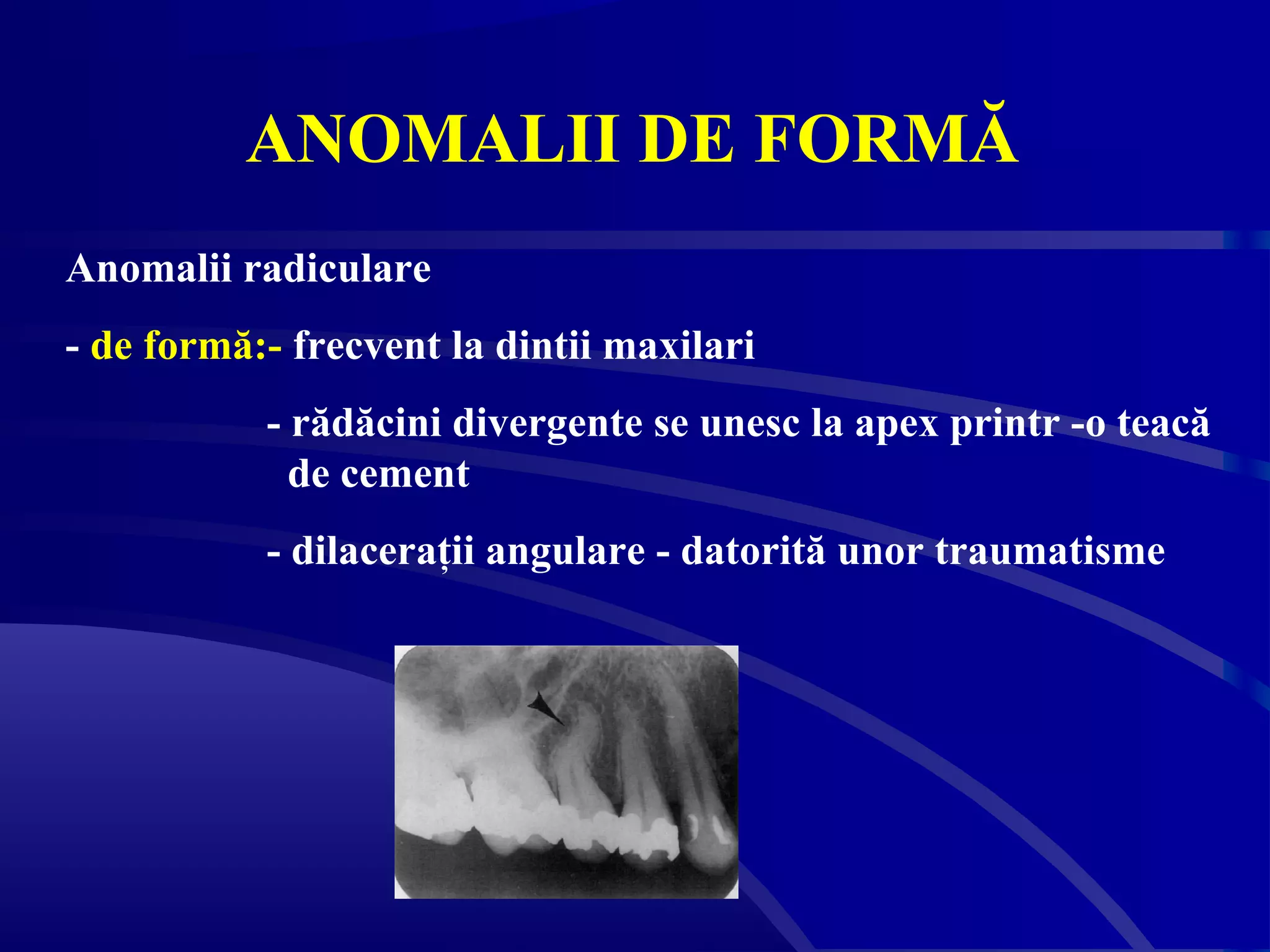 Anomalii dentare | PPT