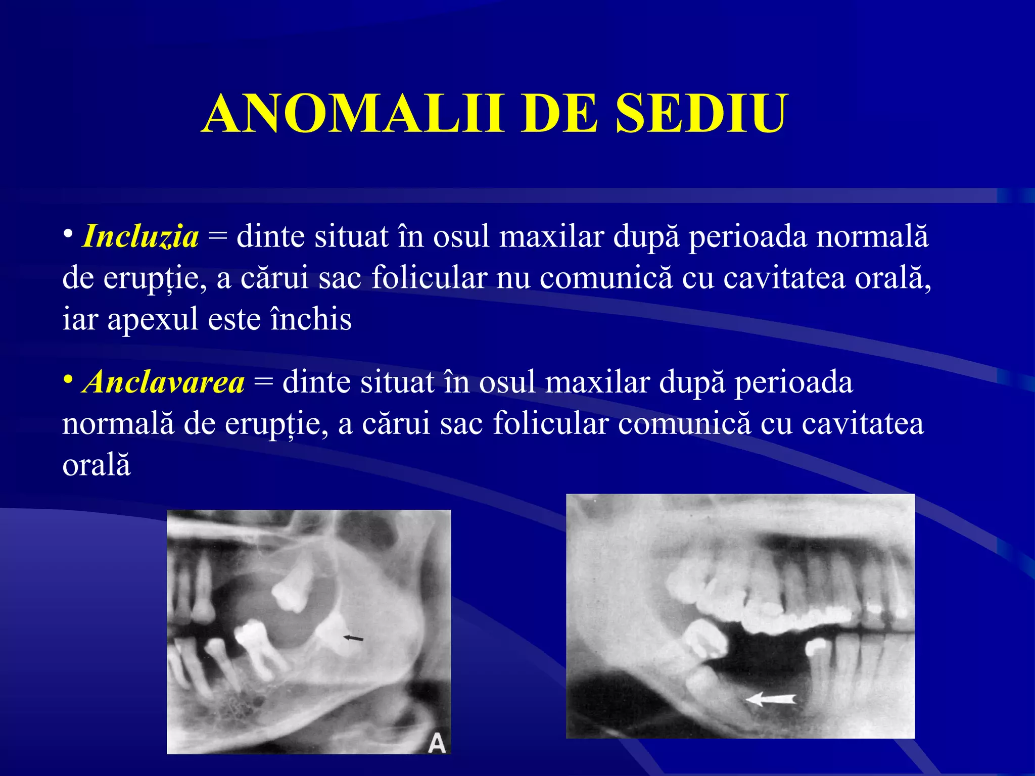 Anomalii dentare | PPT