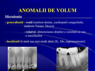 Anomalii dentare | PPT
