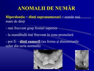 Anomalii dentare | PPT