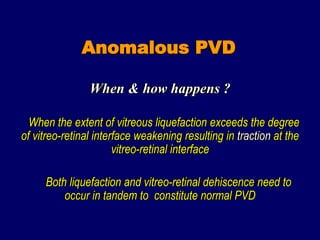 ANOMALOUS PVD IN THE PATHOGENESIS OF VITREO-RETINAL DISEASES | PPT