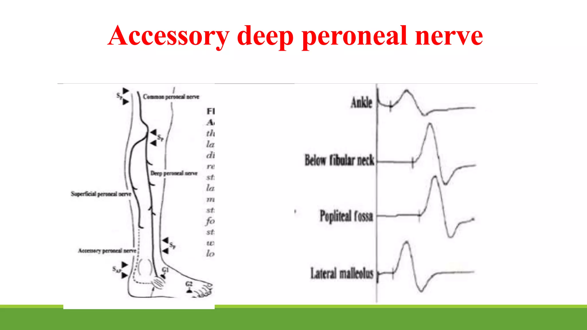 Anomalous innervations | PPTX