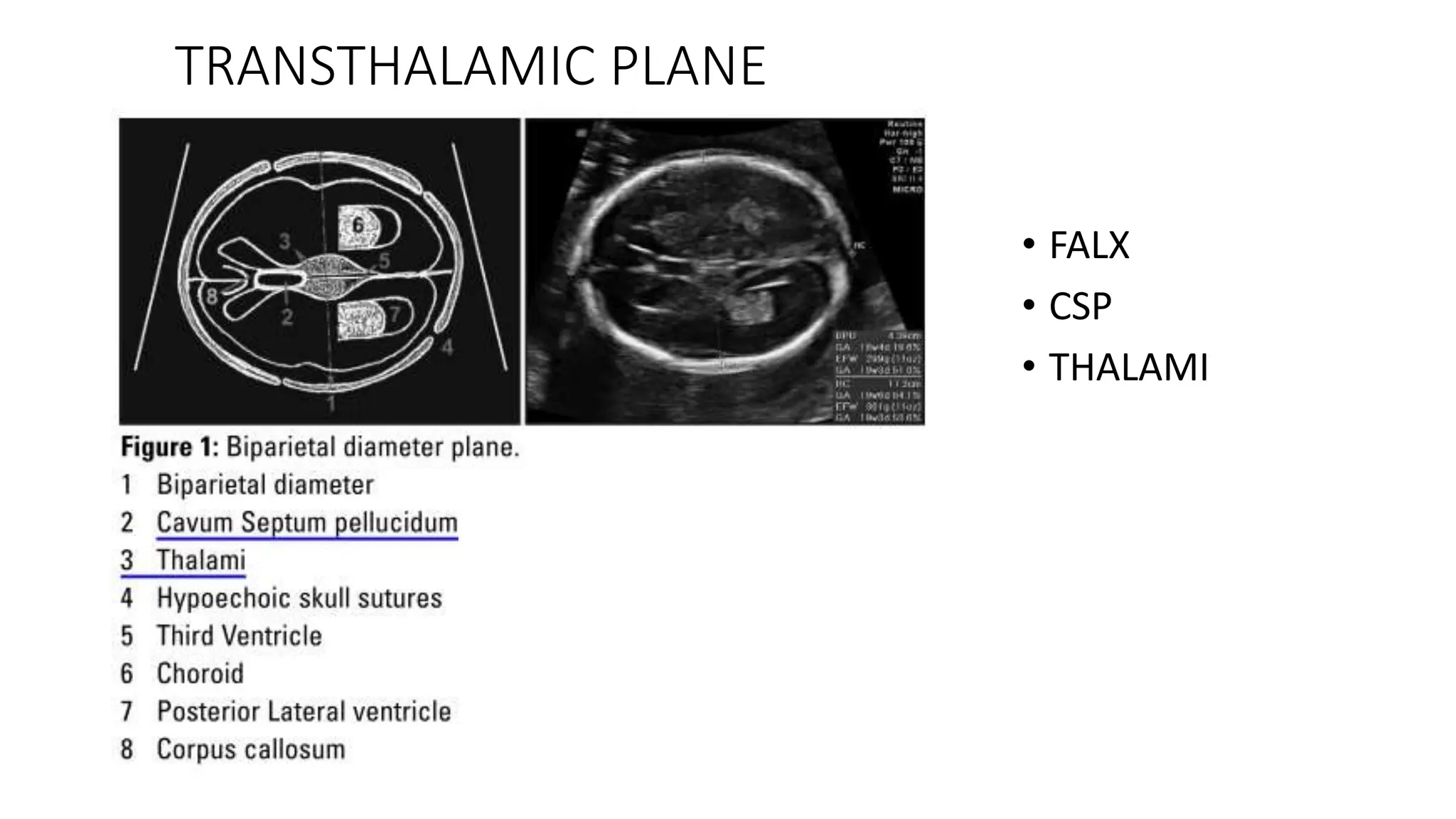 anomaly scan. fetal anomaly scan. second trimester scan | PPTX
