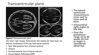 anomaly scan. fetal anomaly scan. second trimester scan | PPTX