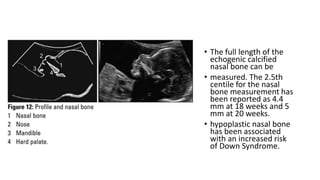 anomaly scan. fetal anomaly scan. second trimester scan | PPTX