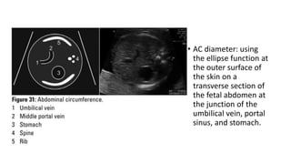 anomaly scan. fetal anomaly scan. second trimester scan | PPTX