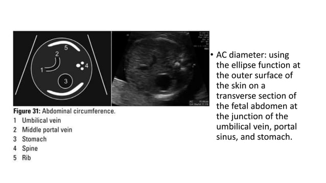 anomaly scan. fetal anomaly scan. second trimester scan | PPTX ...