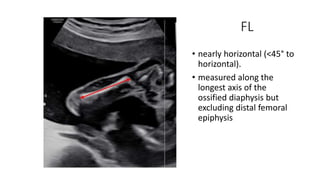 anomaly scan. fetal anomaly scan. second trimester scan | PPTX