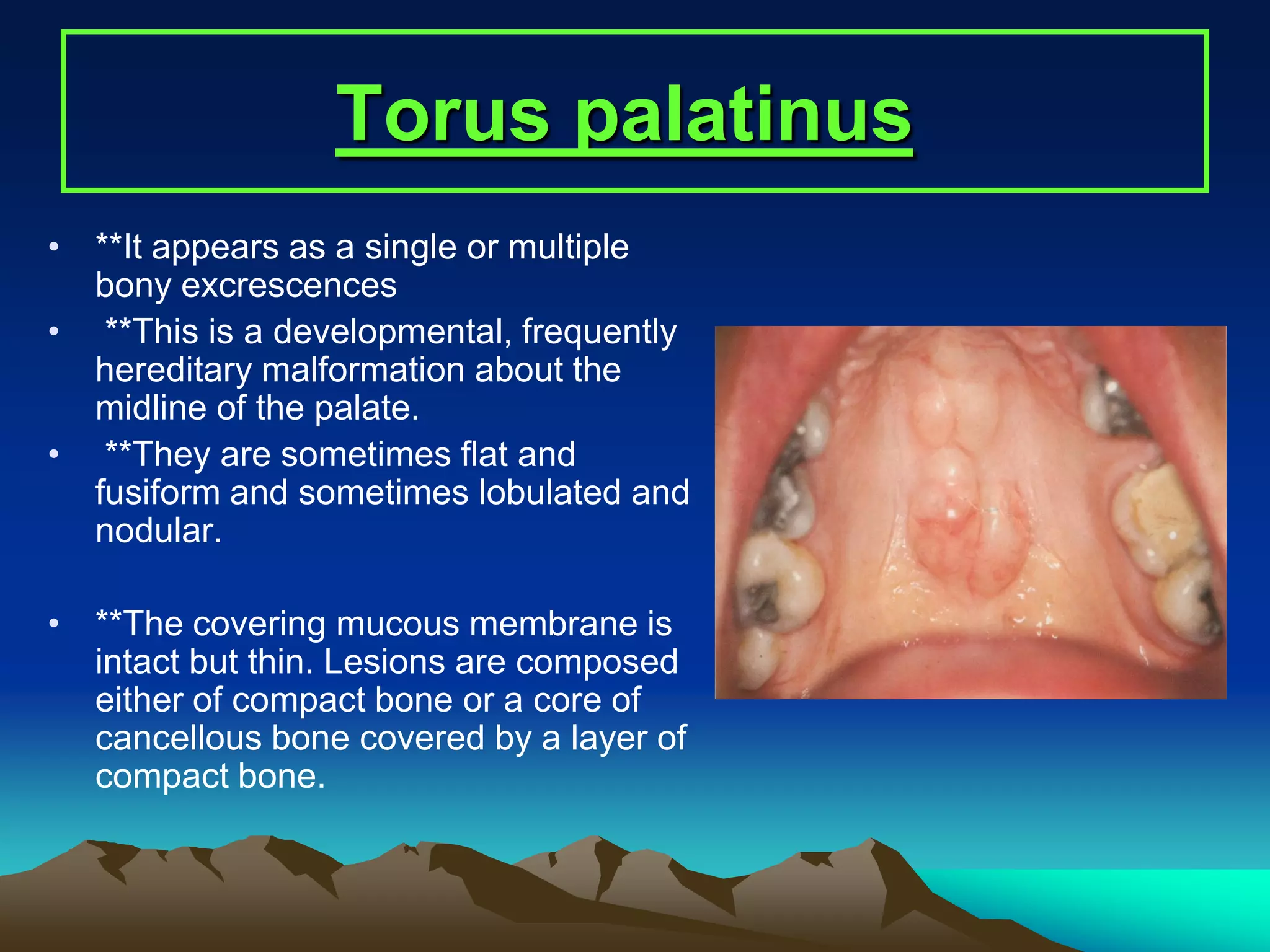 Anomilies Related to Oral and Para-oral Structures | PDF