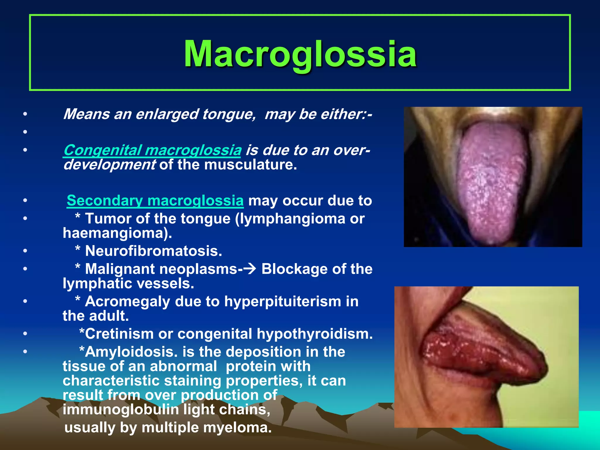 Anomilies Related to Oral and Para-oral Structures | PDF
