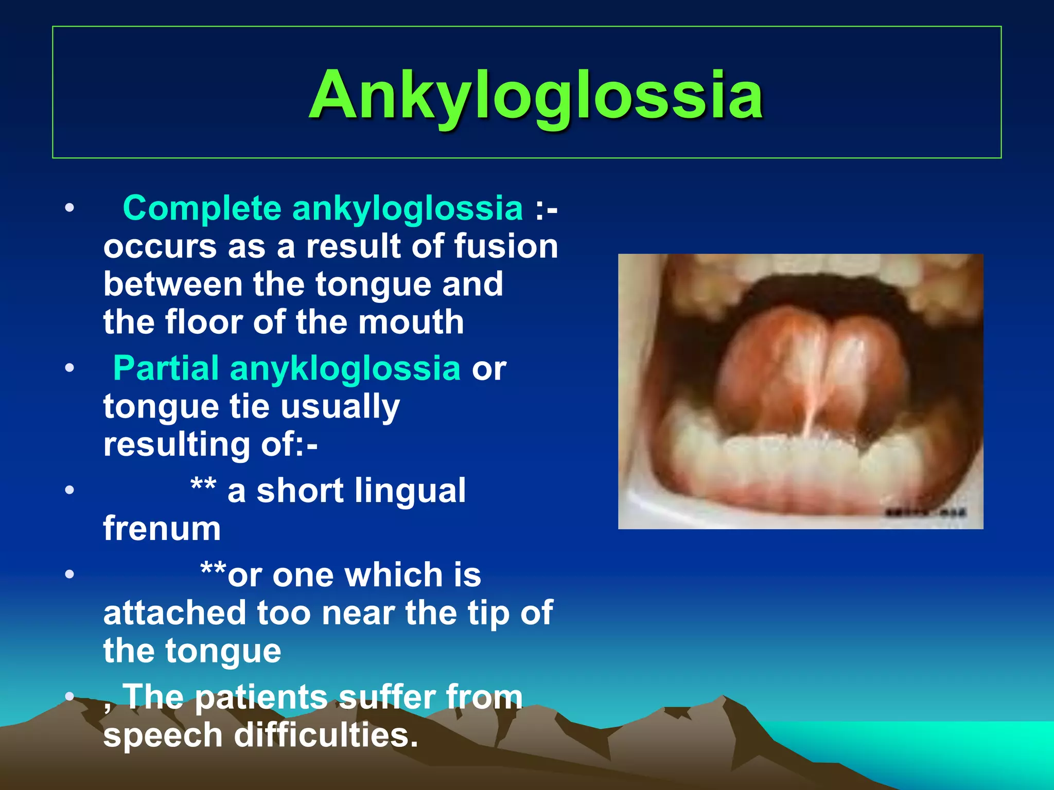 Anomilies Related to Oral and Para-oral Structures | PDF