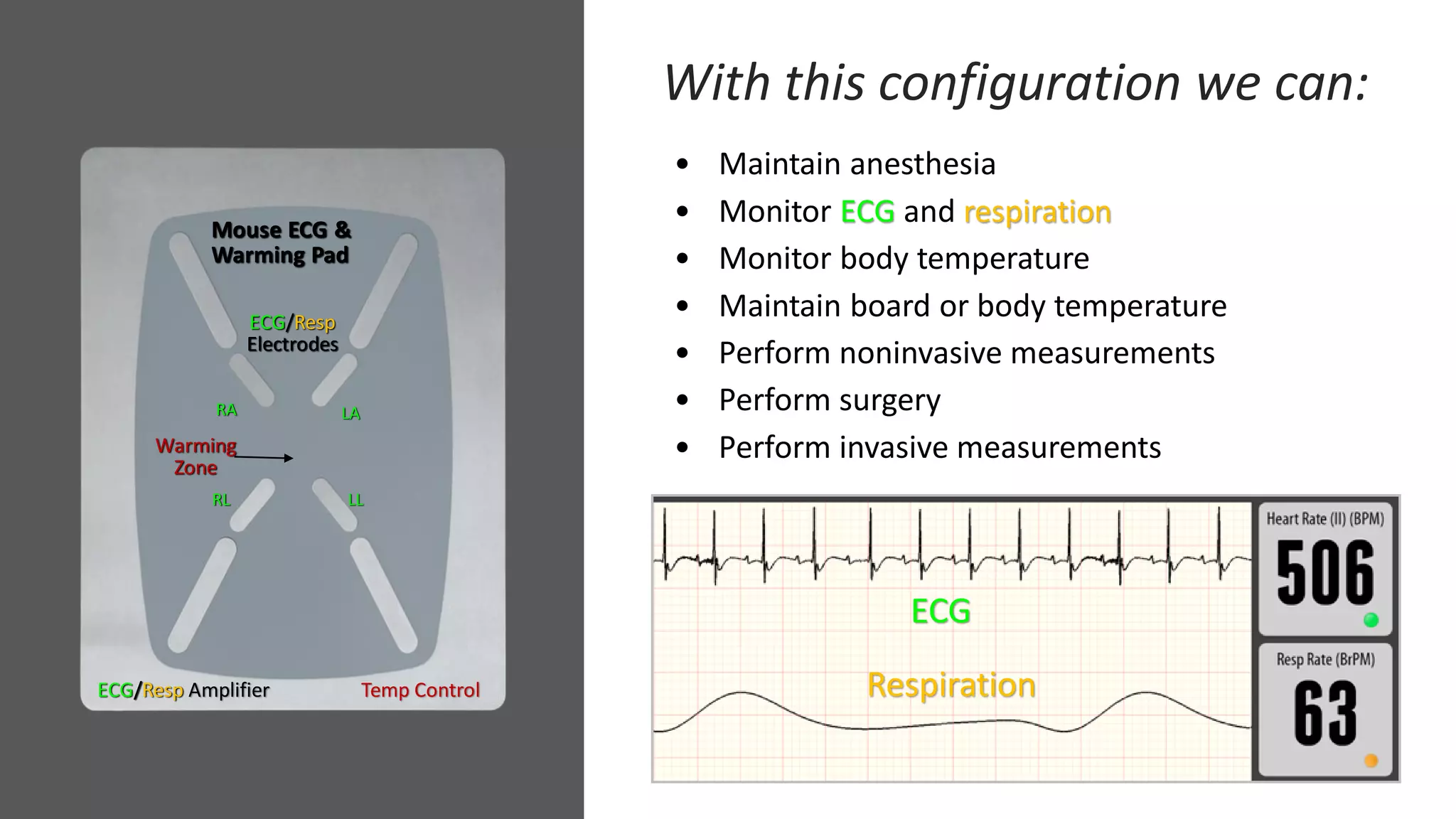 A Noninvasive Alternative to +dP/dtmax: Peak Aortic Blood Acceleration | PDF