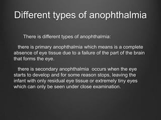 Anophthalmia | PPTX