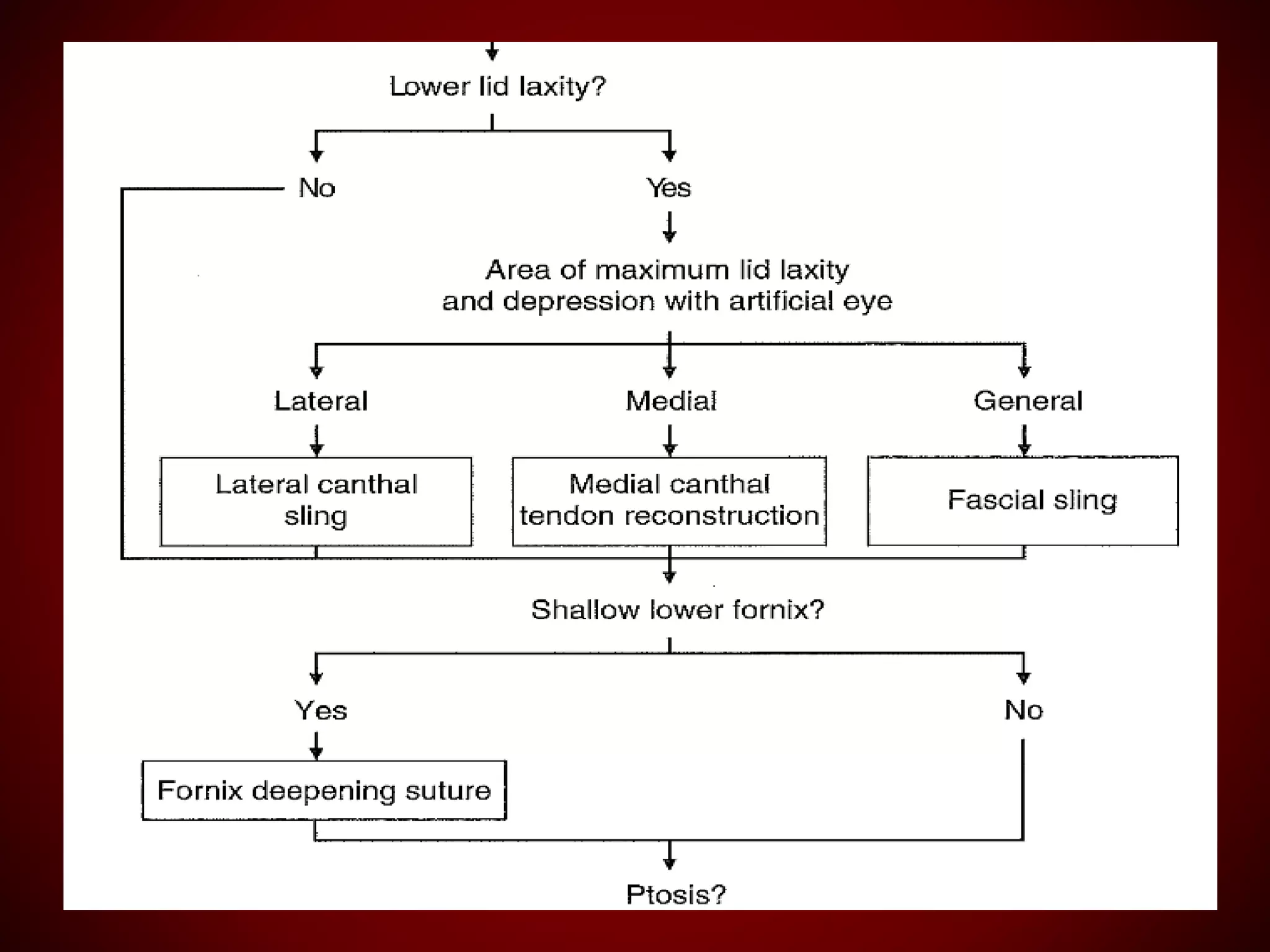 Anophthalmic socket | PPT | Free Download