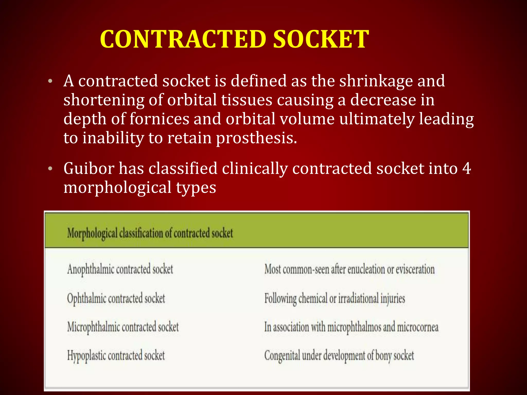 Anophthalmic socket | PPT | Free Download