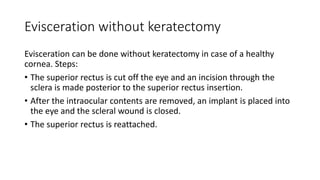 Anophthalmic socket (evisceration, enucleation, exenteration) | PPTX