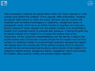 Anophthalmic socket.pptx
