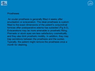 Anophthalmic socket.pptx