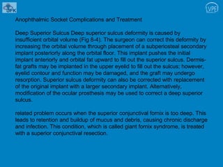 Anophthalmic socket.pptx