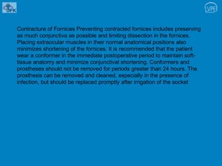 Anophthalmic socket.pptx